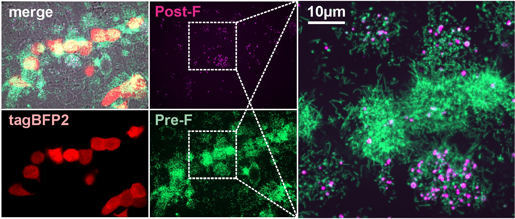 Shape of virus may determine RSV infection outcomes | WashU McKelvey ...
